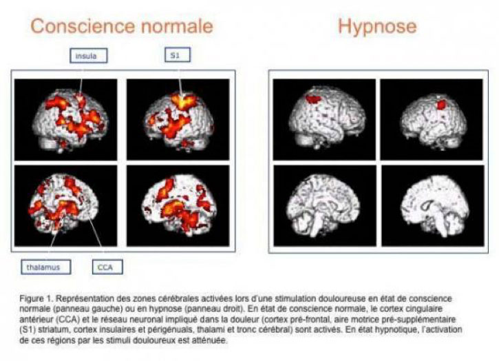 L'hypnose conversationnelle. Comprendre l'hypnose, son fonctionnement.